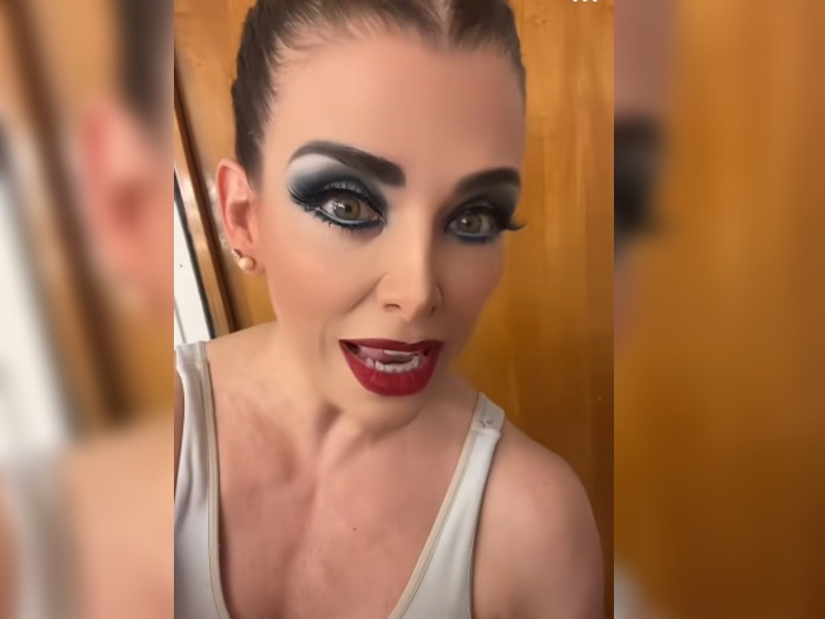 Lisset sufre caída en coladera y muestra sus heridas; recuerda caso de ...