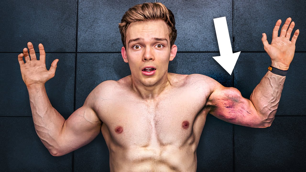 I Experienced the Pain of a Muscle Tear for 24 Hours