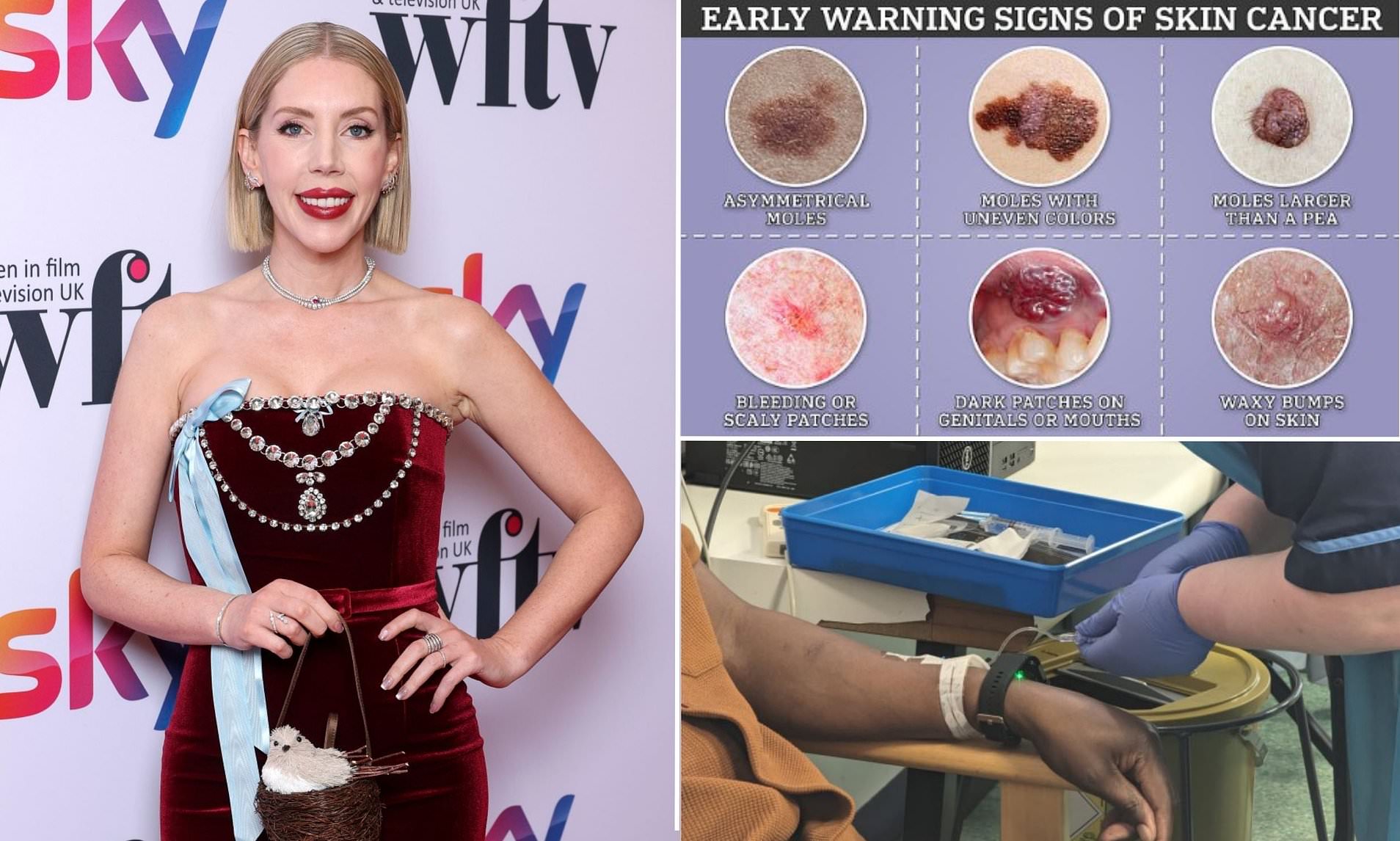 Life-saving cancer vaccine for thousands with deadly skin cancer