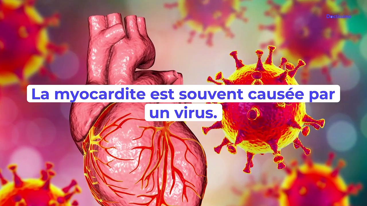 Myocardite : symptômes, causes, traitements 🫀