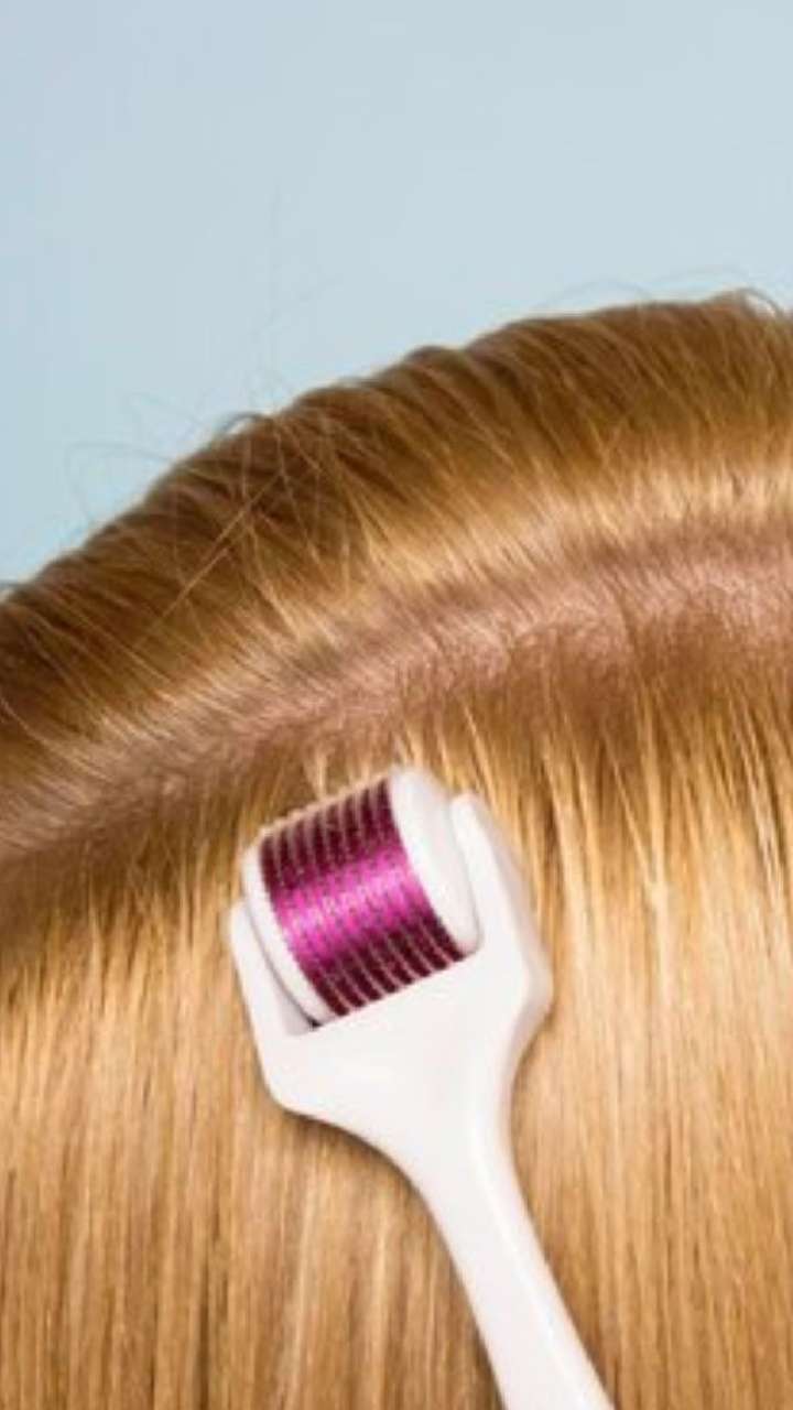 7 Benefits Of Using Derma Roller For Hair Growth