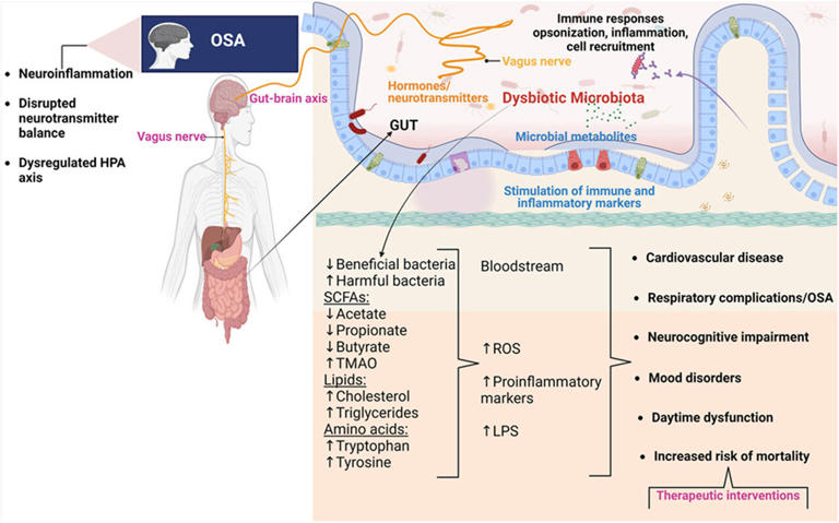 Sleep apnea research links gut health to new treatment possibilities