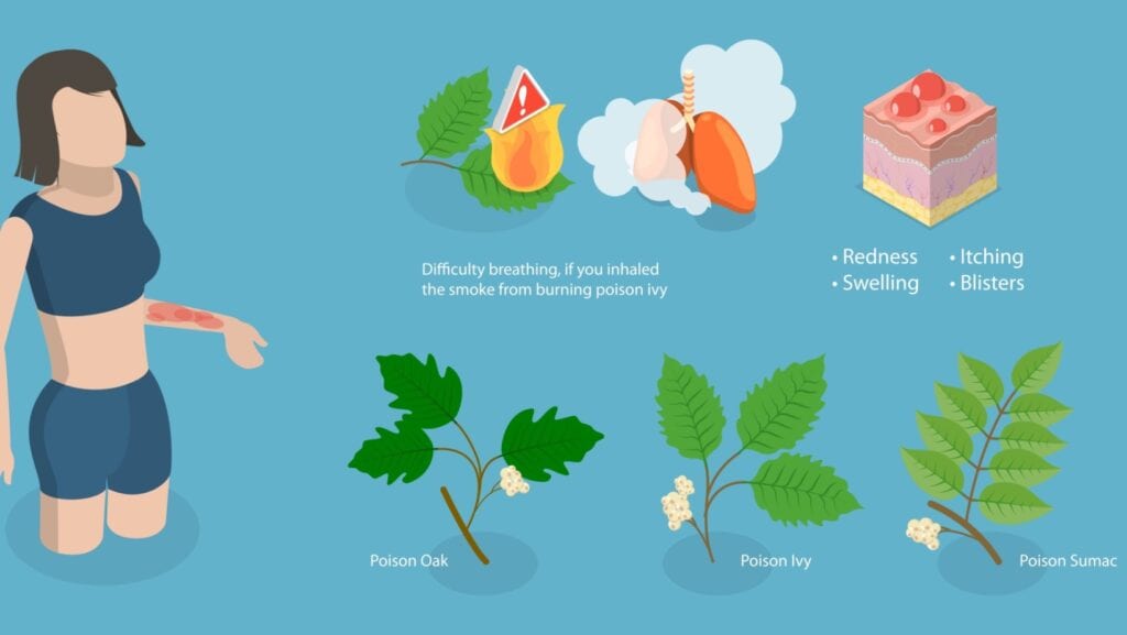 Why Poison Ivy Is More Dangerous Than You Think-Even If You Were Once ...