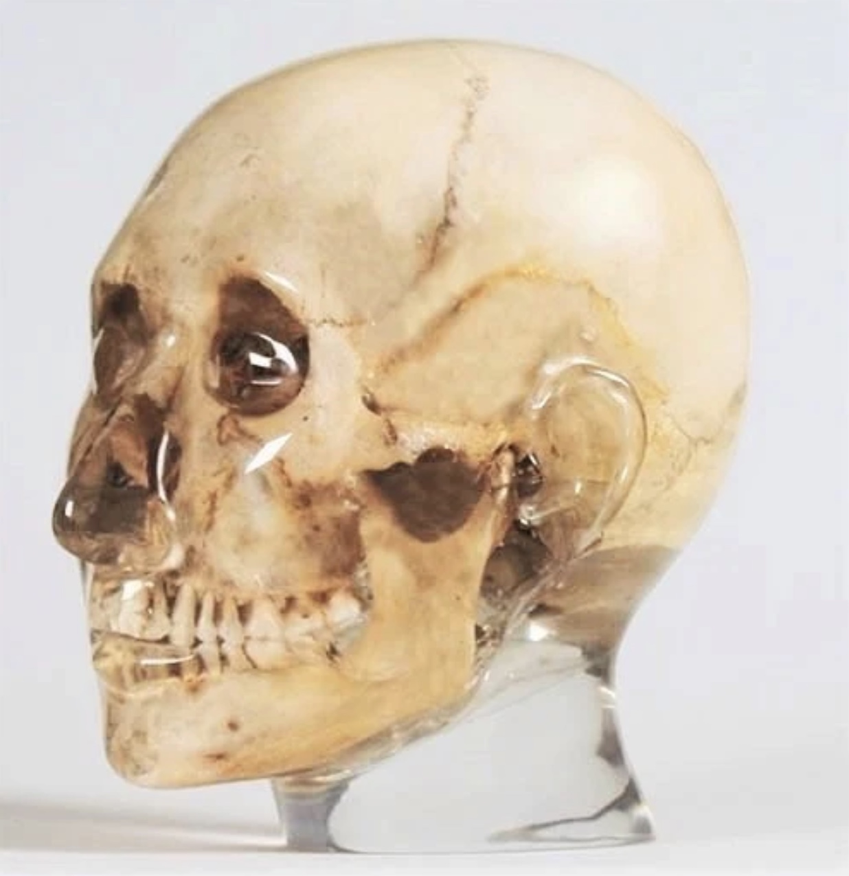 29 Creepy Fake Human Bodies for Practicing X-Rays