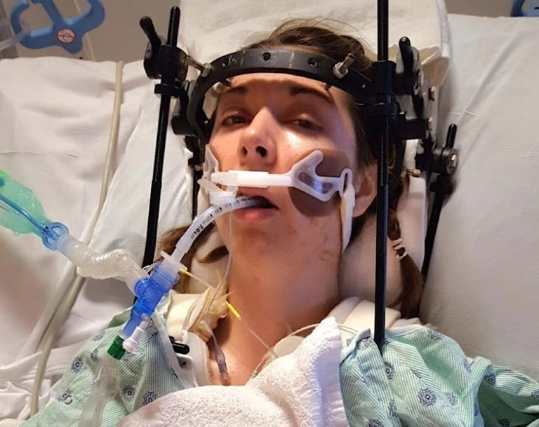 Decapitated woman’s head reattached after freak gym class accident ...