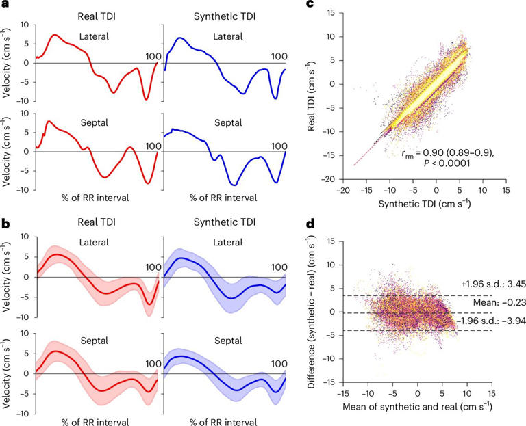AI recreates the motion of a beating heart using surface electrical ...