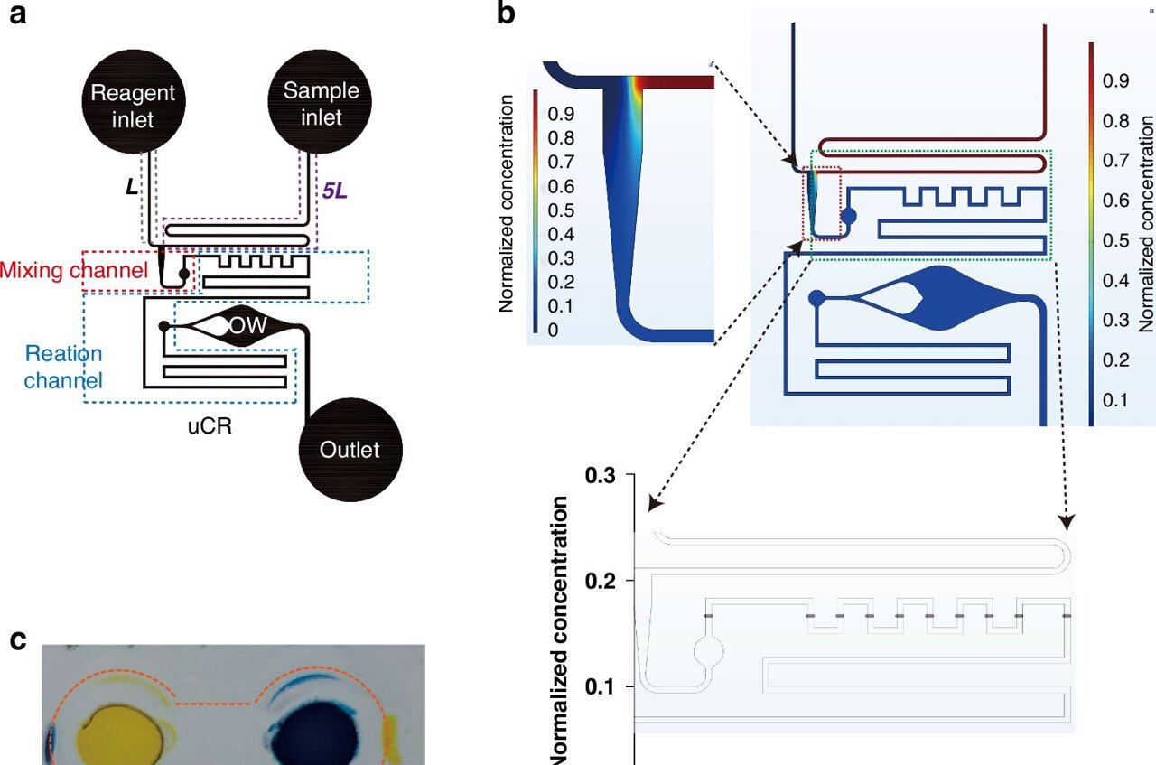 Diagnostic tool for kidney disease could help individuals take greater ...