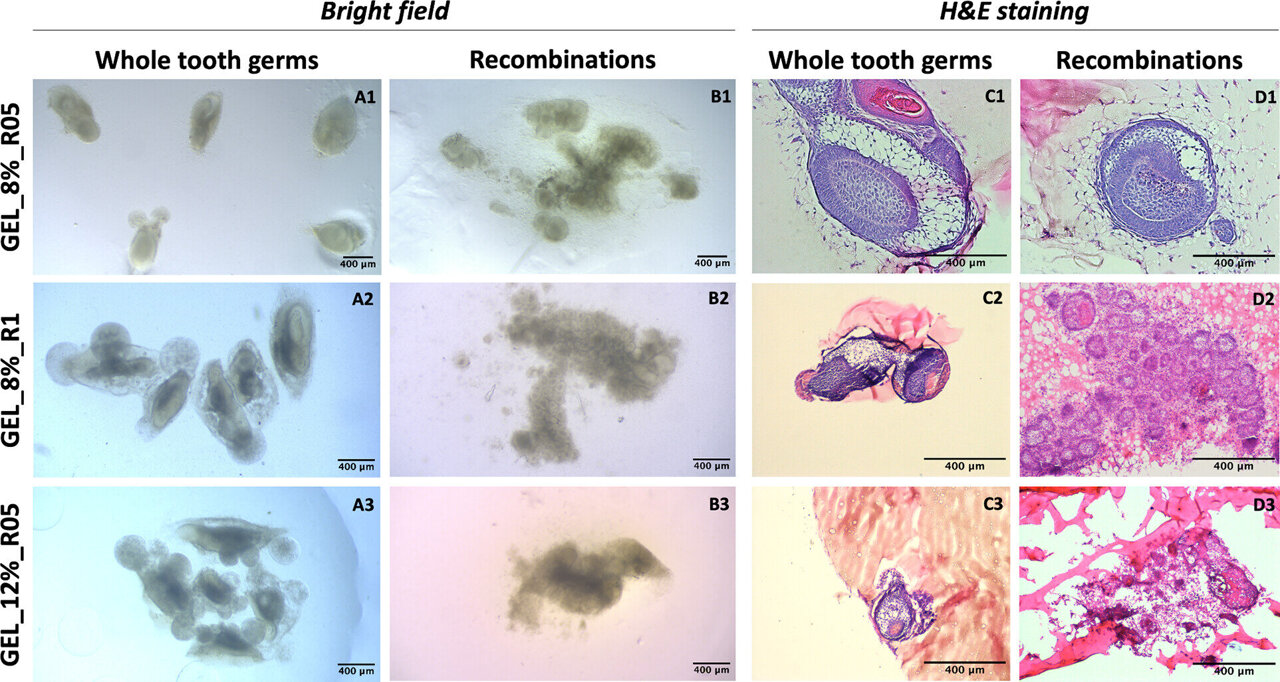 Lab-grown teeth might become an alternative to fillings