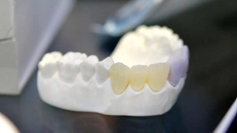 Scientists grow human teeth in a lab, and it may change dentistry forever