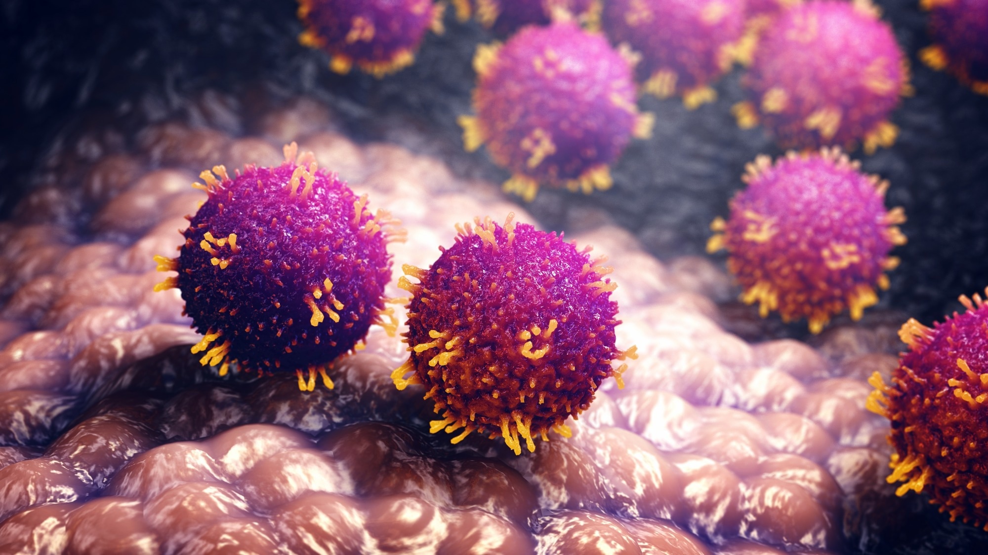 Why measles is back in the U.S. and what doctors must know now