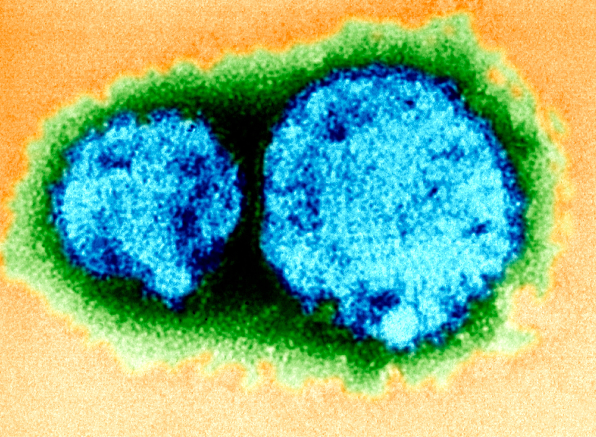 WHO seeks 82 passengers from flight with hantavirus-infected woman