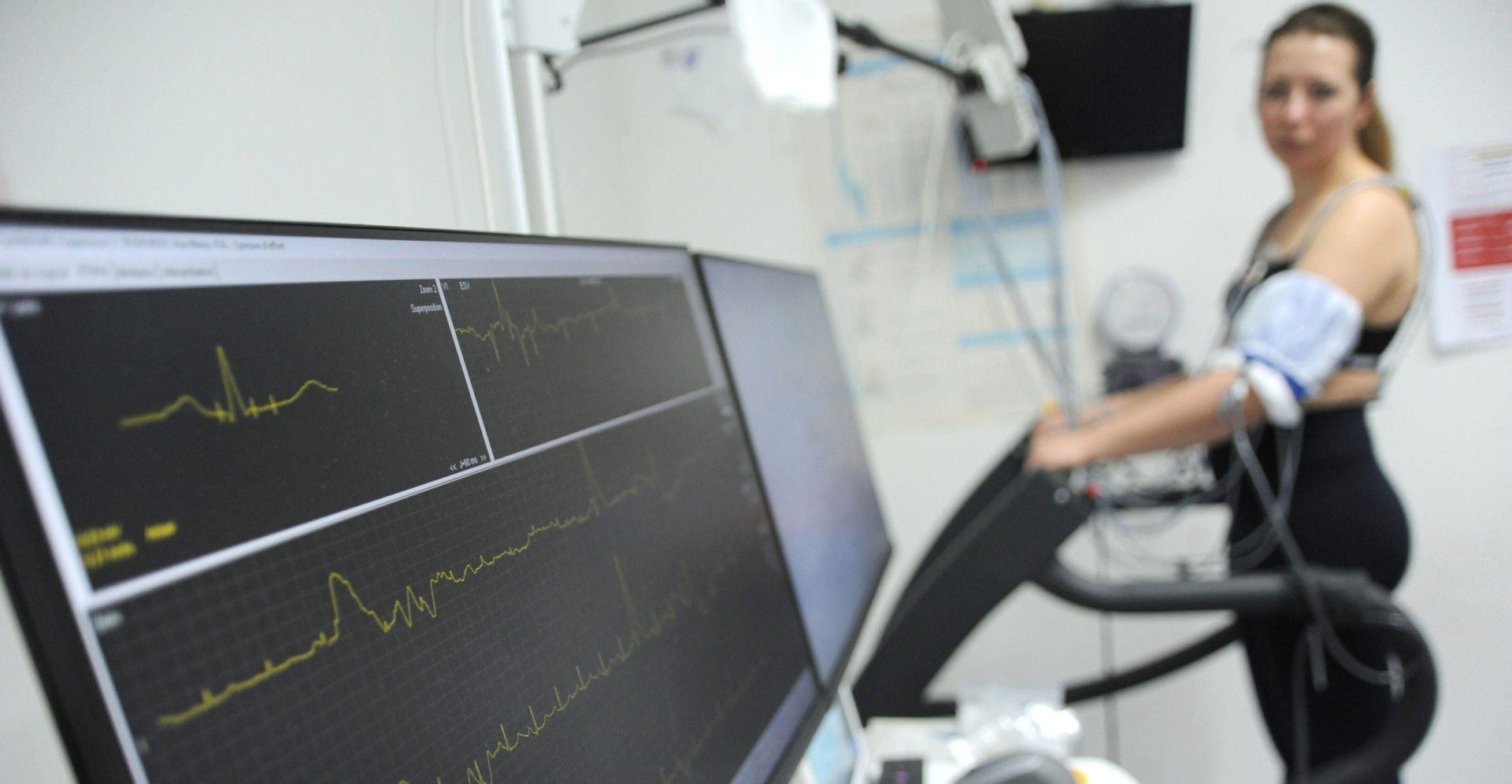 The importance of cardiac clearance for your health