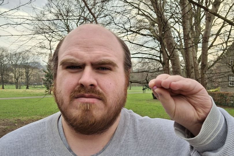Scot stunned to find Lego brick stuck in ear for 20 years