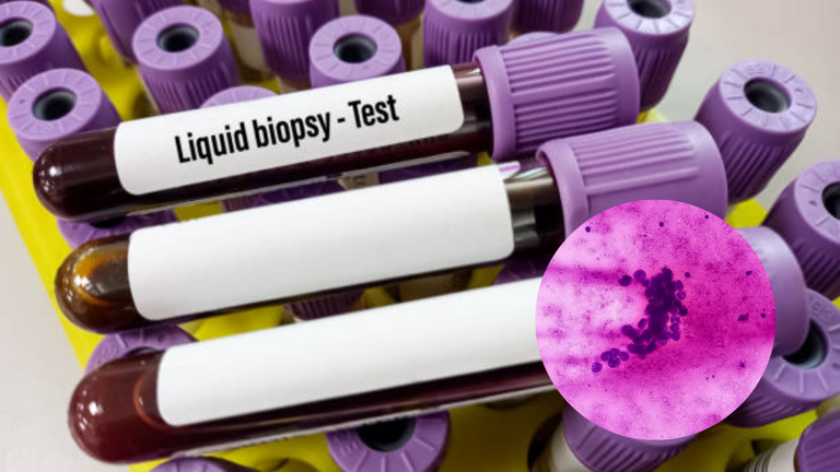 Find And Fight Cancer: Experts Weigh In On What Liquid Biopsies Can Detect, Its Emerging Uses ...