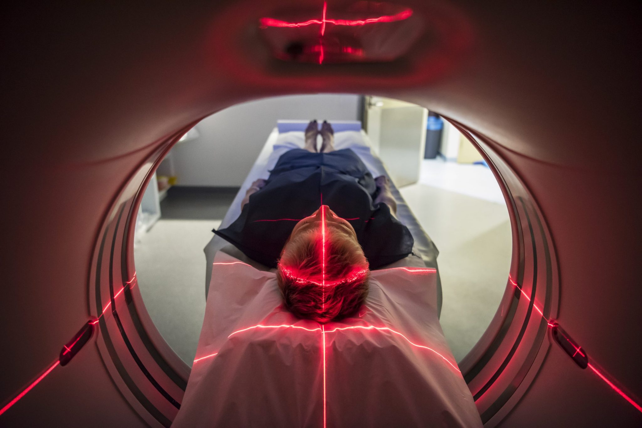 The truth about CT scans: The common health check could drive 103,000 ...