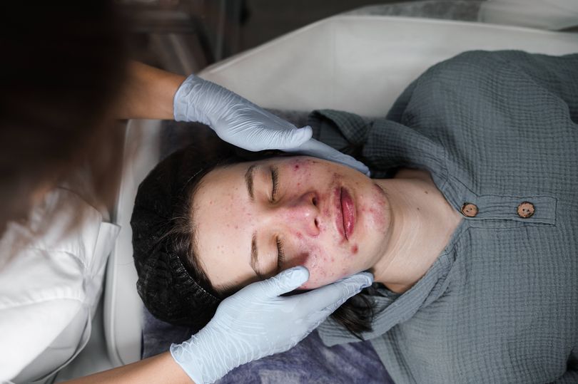 Help scars fade faster with dermatologist's three simple steps