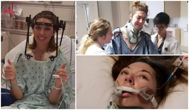 En raro caso, mujer sobrevive a “decapitación interna” y se convierte ...