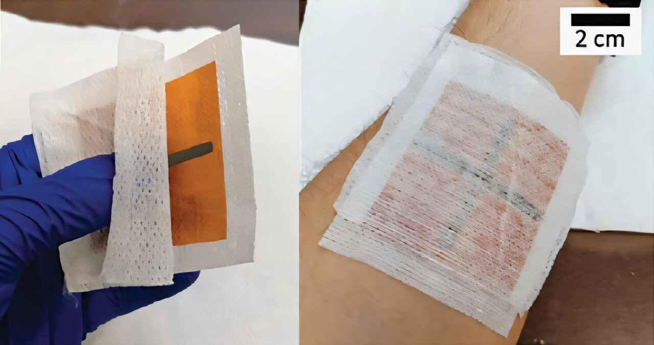 Smart skin sensor offers real-time infection detection