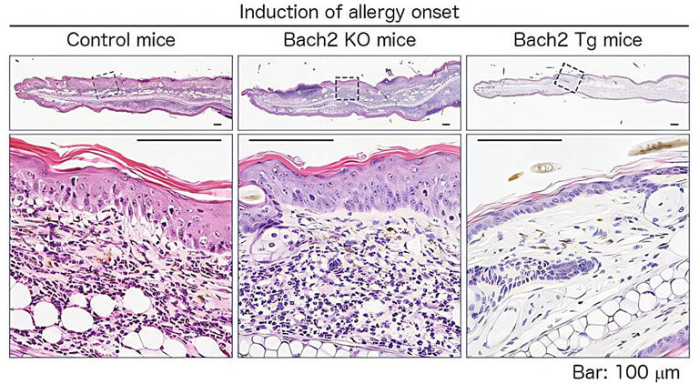 Researchers investigate characteristics of lymphocytes that prolong ...