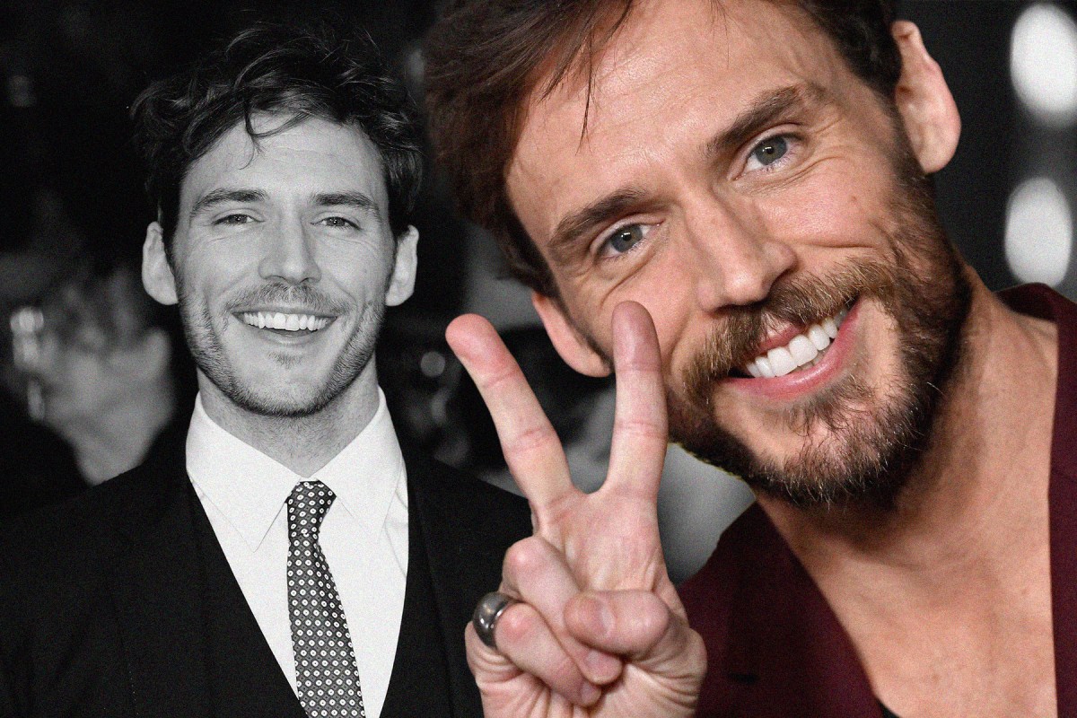 Take It From a Woman: I’m Begging You to Not Get Veneers