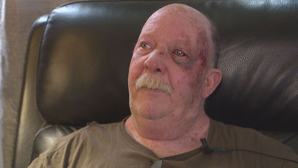 'It was a nightmare': Victim recalls brutal beating during Waterloo ...