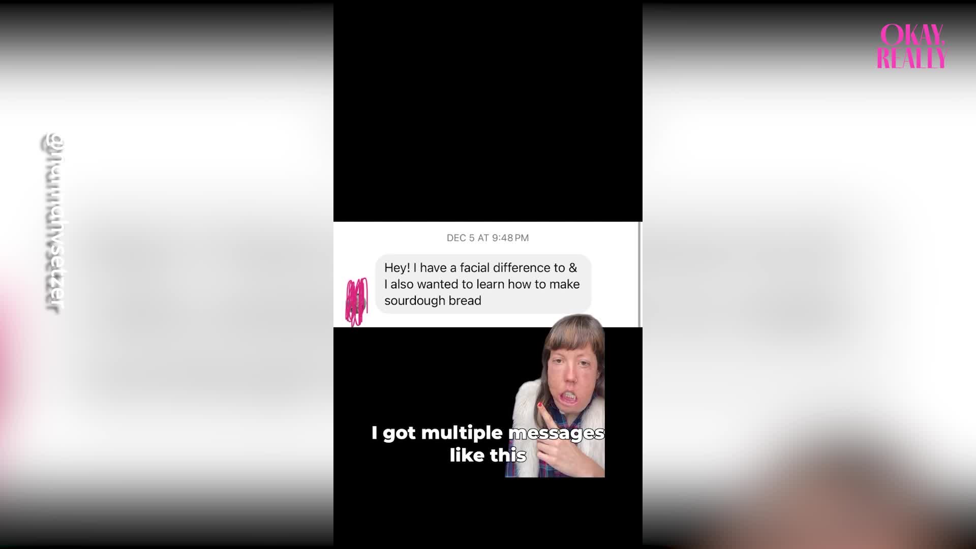 Woman With Rare Genetic Condition Advocates for Disability Representation