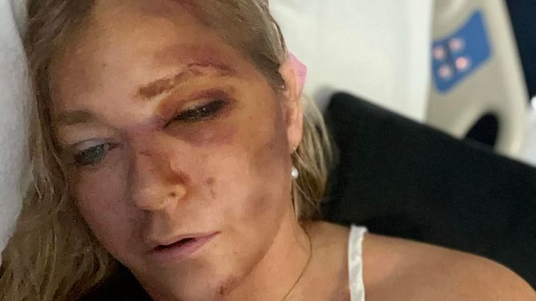 Vermeend slachtoffer prins Andrew uit ziekenhuis ontslagen na 'zeer ...