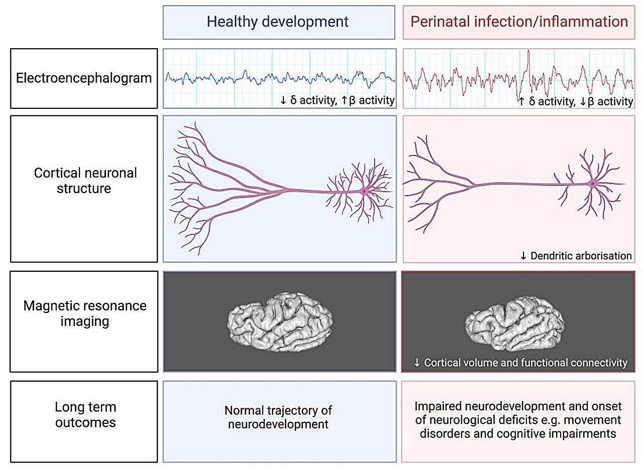 Understanding the mechanics of perinatal brain inflammation