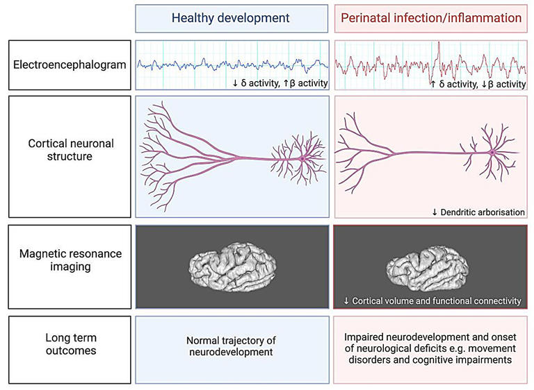 Understanding the mechanics of perinatal brain inflammation