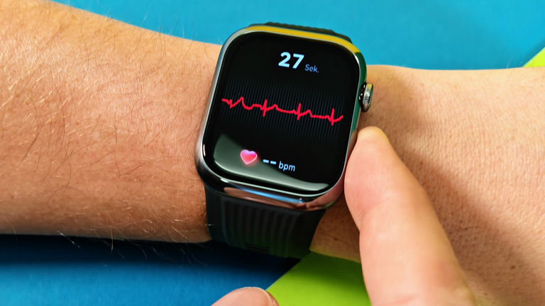 Top 10: Die beste Smartwatch mit EKG im Test – Testsieger misst Blutdruck