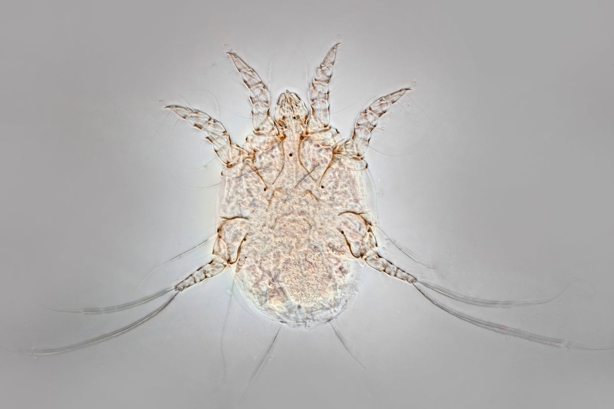 How to spot, treat and prevent scabies, according to the experts