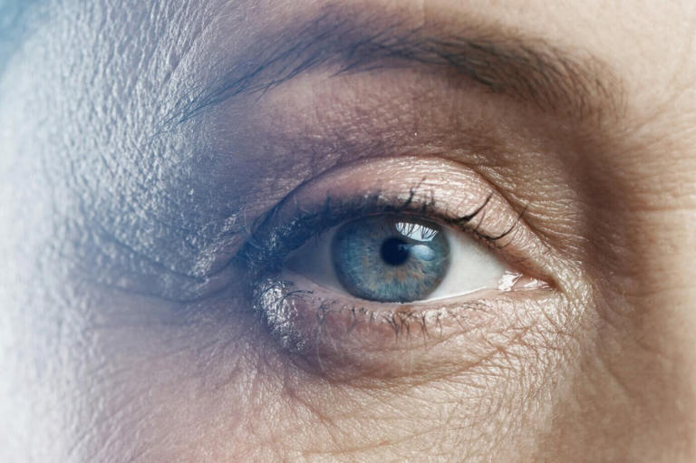 Here’s How I Knew I Had Glaucoma: A Patient’s Story After Putting Off ...