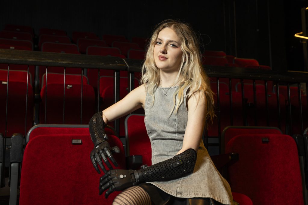 Amputee influencer helps develop world’s most advanced bionic arms