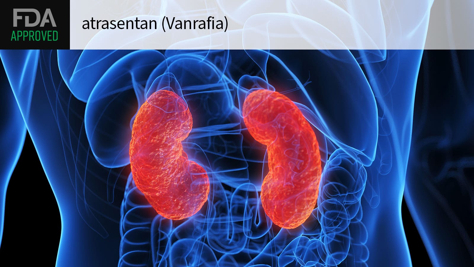IgA Nephropathy Drug With Novel Mechanism Wins FDA Approval