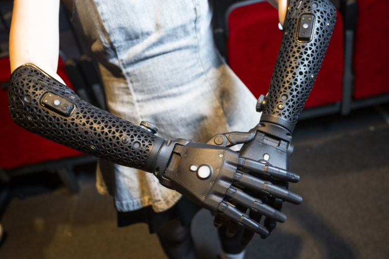 Amputee influencer helps develop world’s most advanced bionic arms