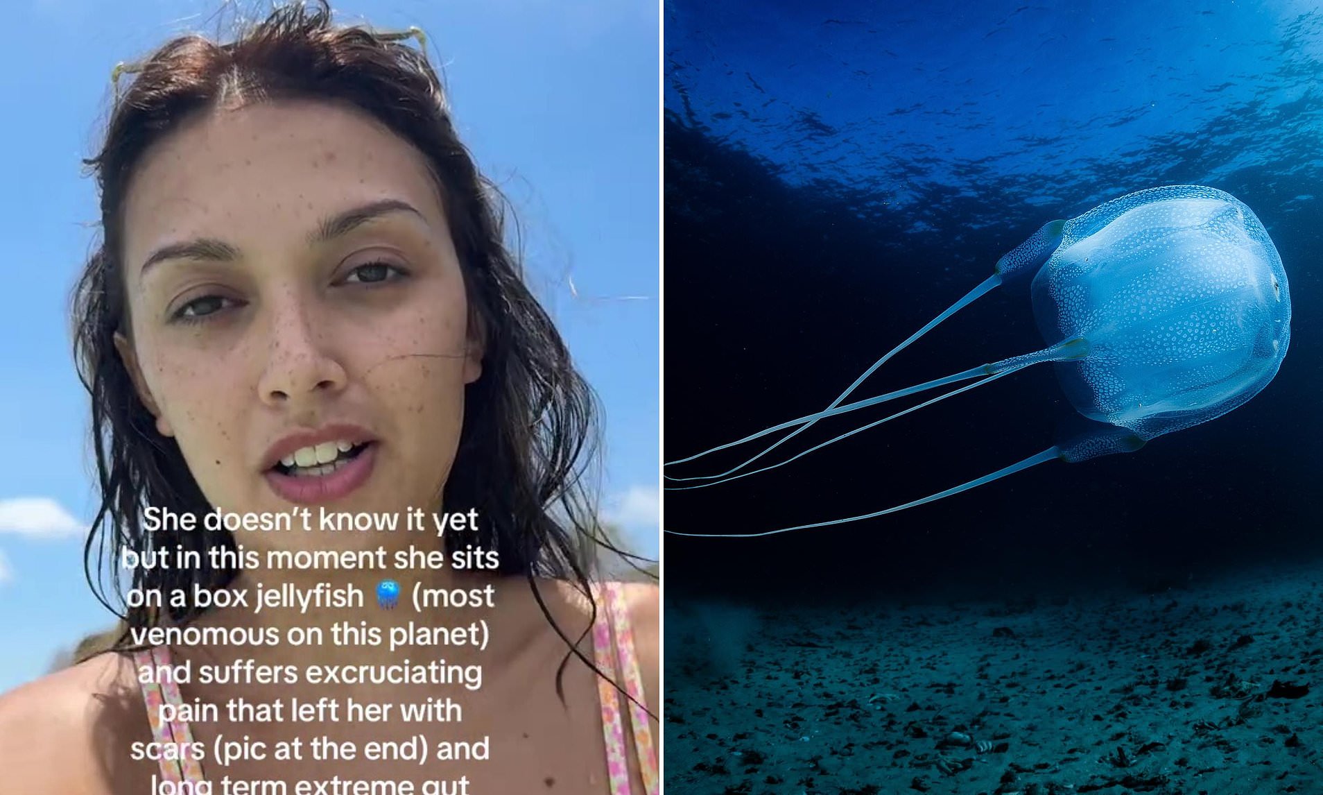 Influencer stung by deadly jellyfish saved by quick-thinking Aussie