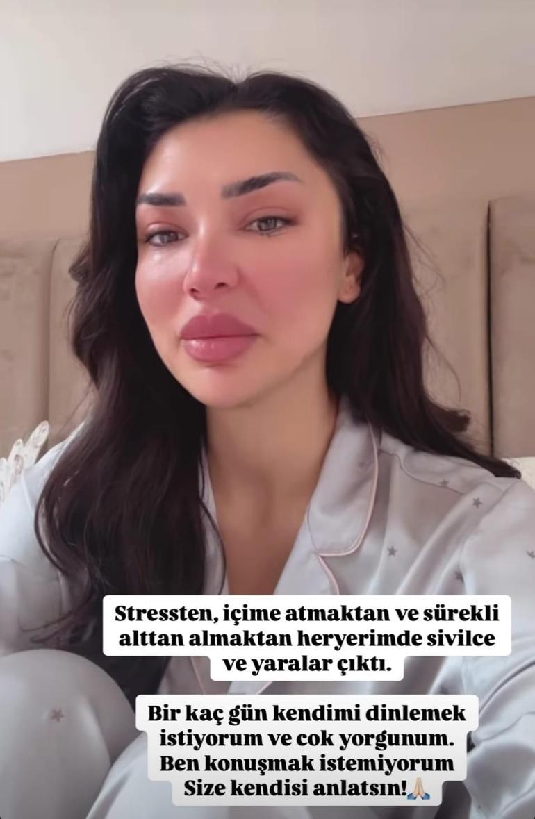 'Kısmetse Olur' Aycan ve Onur çiftinden kötü haber! Ağlayarak duyurdu