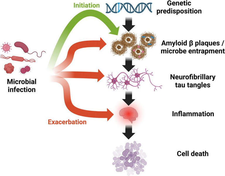 Microbial infections in the brain might play a significant role in ...
