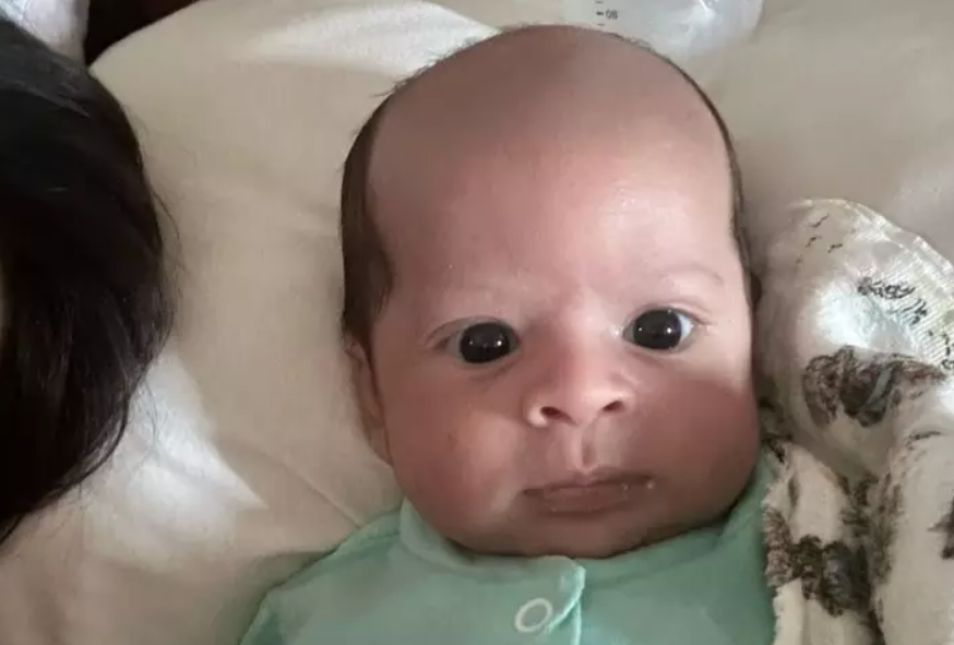 Bebê 'calvo de nascença' conquista internautas devido a sua aparência ...