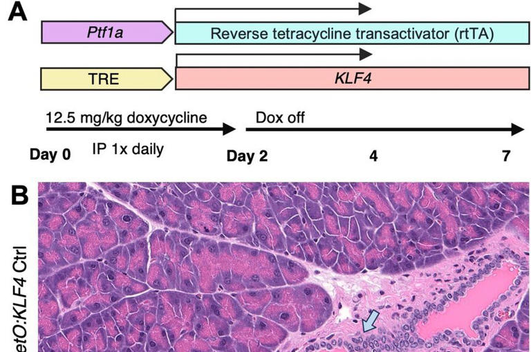 Pancreatic cells 'remember' cancer-linked epigenetic marks without ...