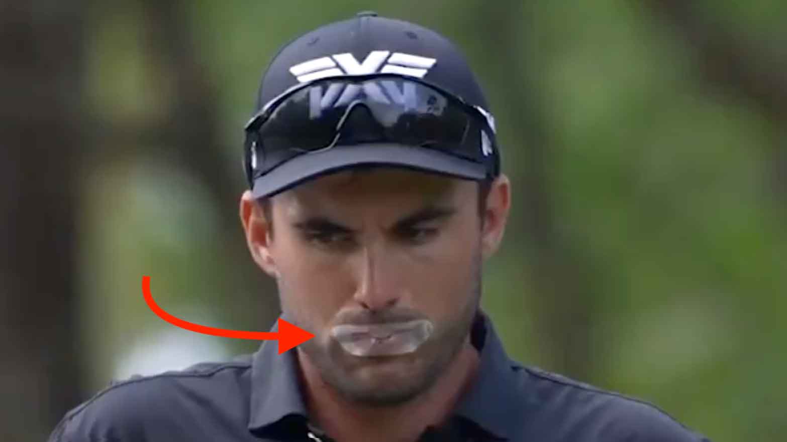 ‘Angry' pro takes outrageous measure to silence self-loathing