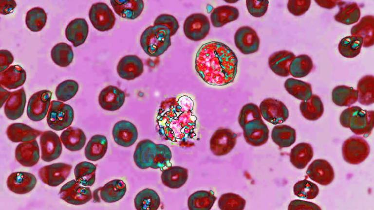 Drug makes blood toxic to malaria-spreading mosquitoes