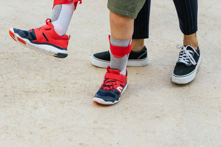 Understanding and managing duck-footedness: A comprehensive guide