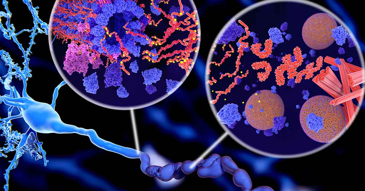 How to clear the toxic tau protein that can lead to Alzheimer's and ...