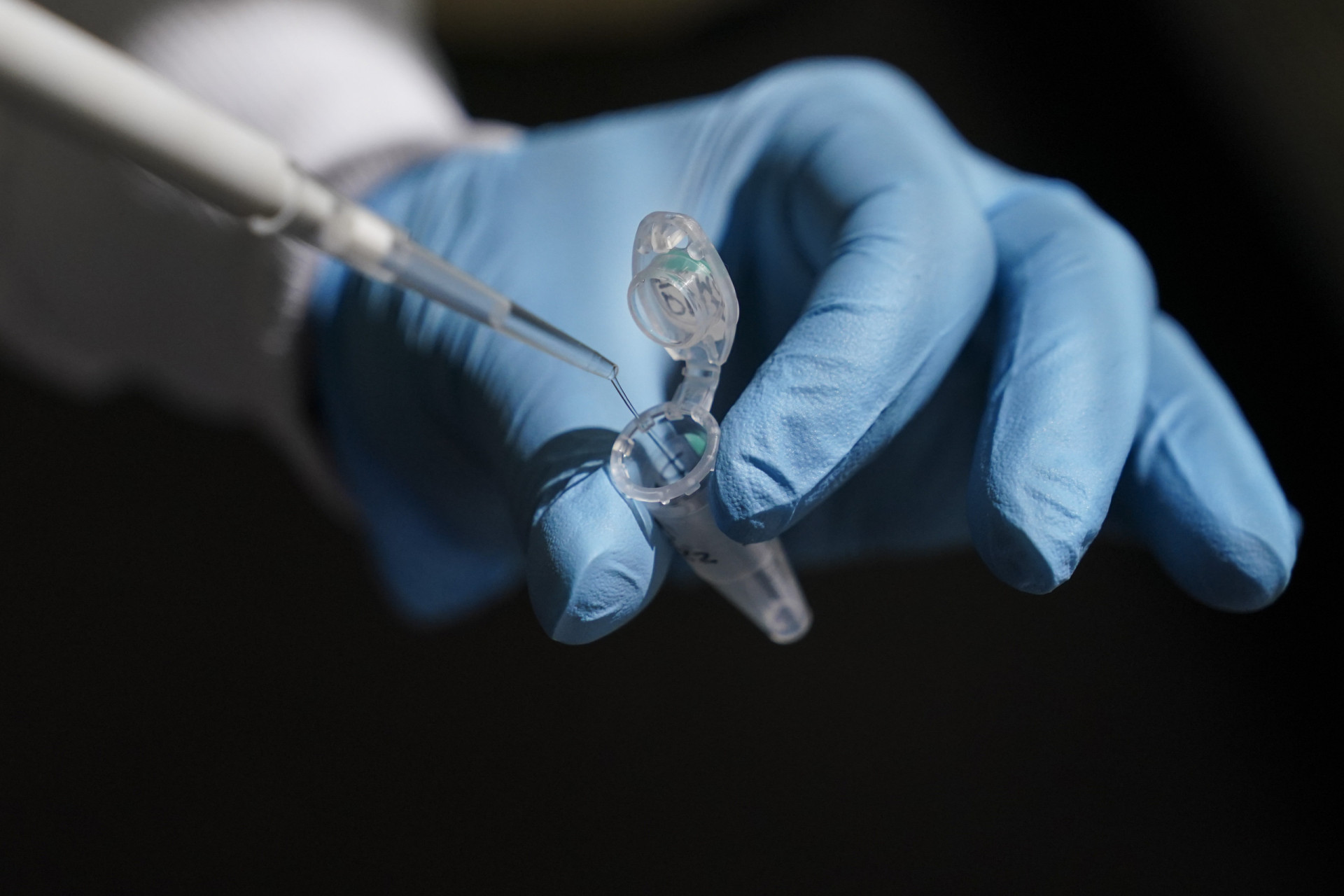 Chimérisme humain : comprendre cette rare particularité génétique