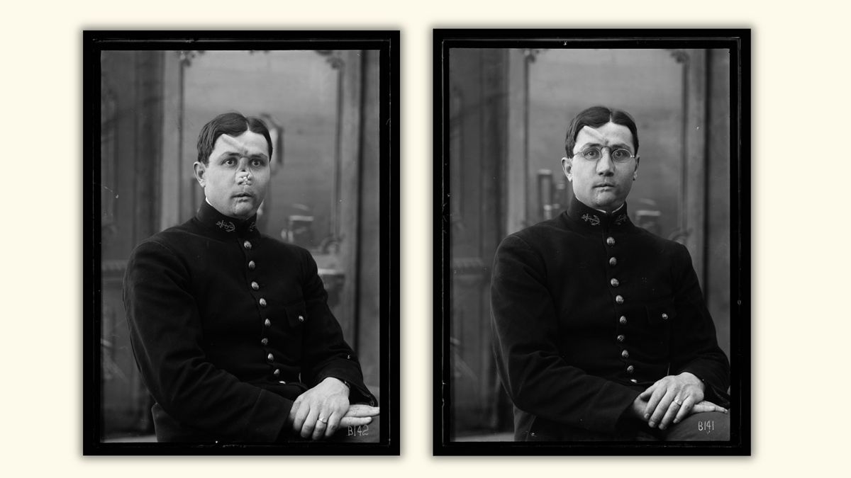 Yes, these WWI-era facial prosthetics are real — but the sculptor ...