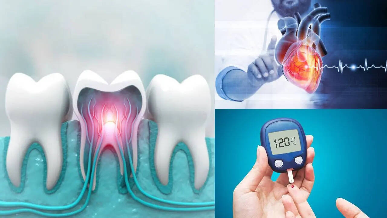 Poor Dental Conditions Can Worsen Existing Chronic Diseases, Says Top ...