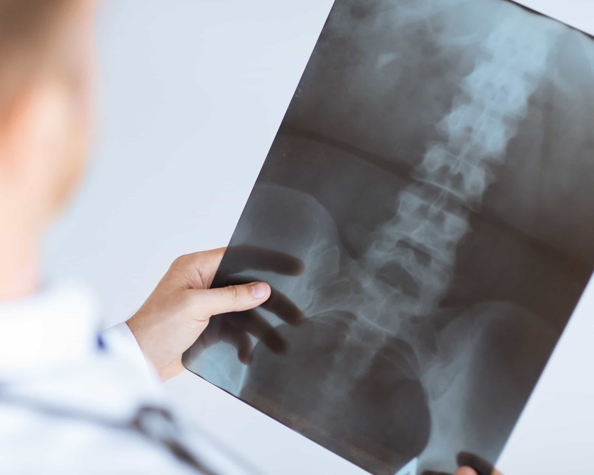 What to eat for good spinal health