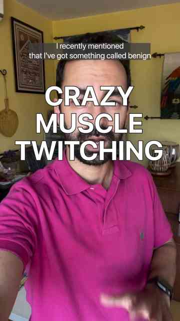 Benign fasciculation syndrome explained - why your muscles twitch