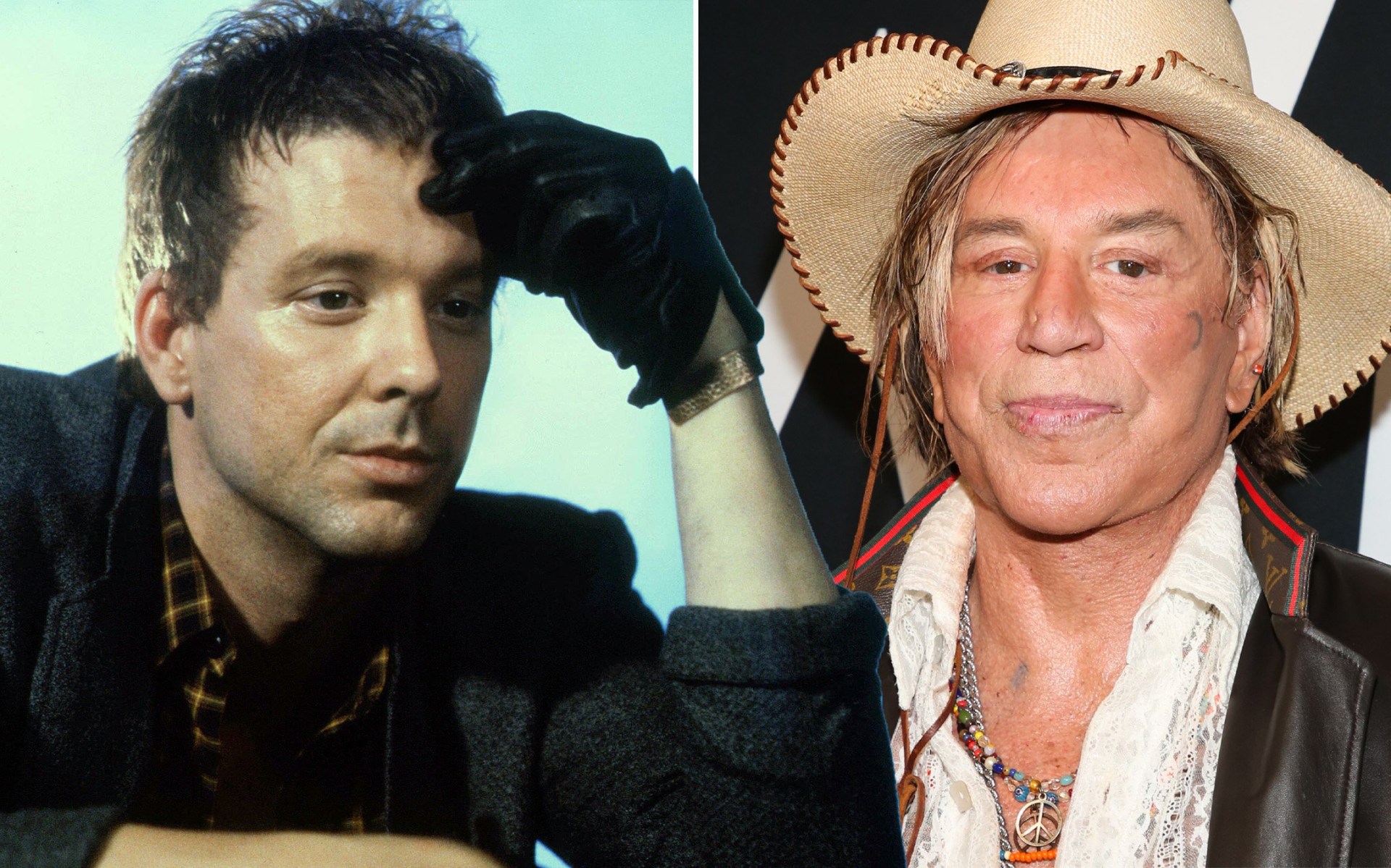 What happened to Celebrity Big Brother's Mickey Rourke's face after ...